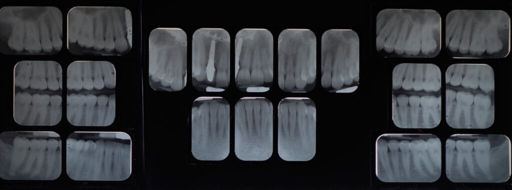 New Patient Guide - Creative Dental Specialists - Scottsdale, AZ