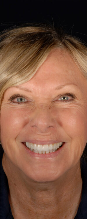 Creative Dental Specialists - Dentistry, Restorative, Cosmetic