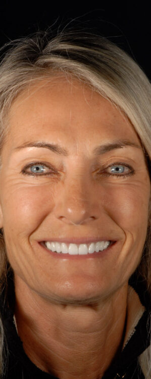 Creative Dental Specialists - Dentistry, Restorative, Cosmetic